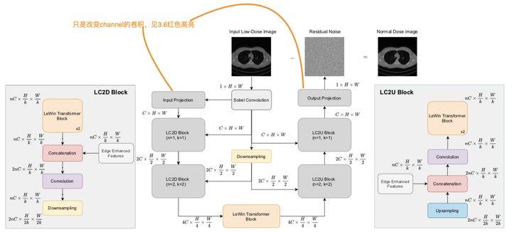 LDCT图像重建论文——Eformer: Edge Enhancement based Transformer for Medical Image Denoising - 知乎