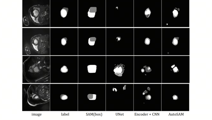 医疗SAM也来啦 | AutoSAM告诉你如何在医疗领域更快更好开发大模型 - 知乎