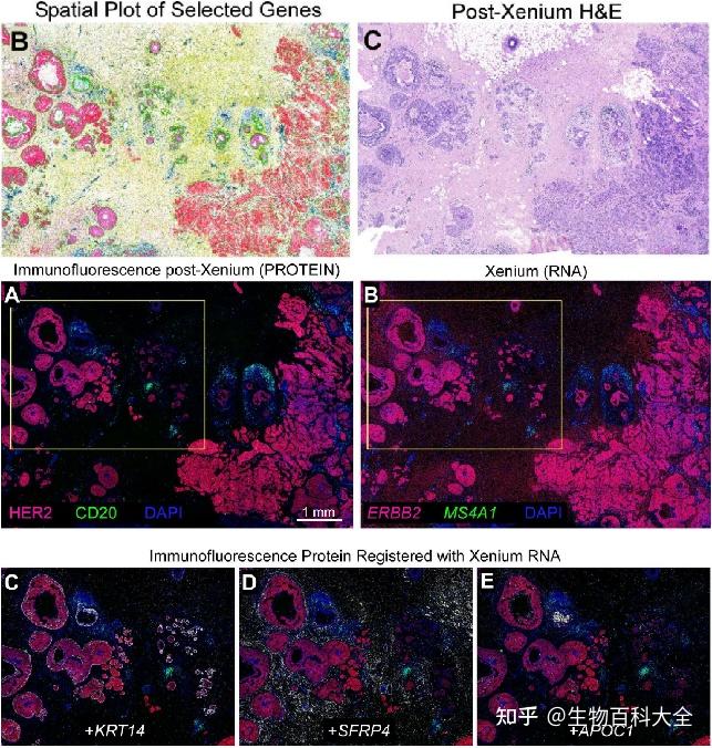 Xenium空间原位分析高端局—从文献解析到研究思路大揭秘 - 知乎