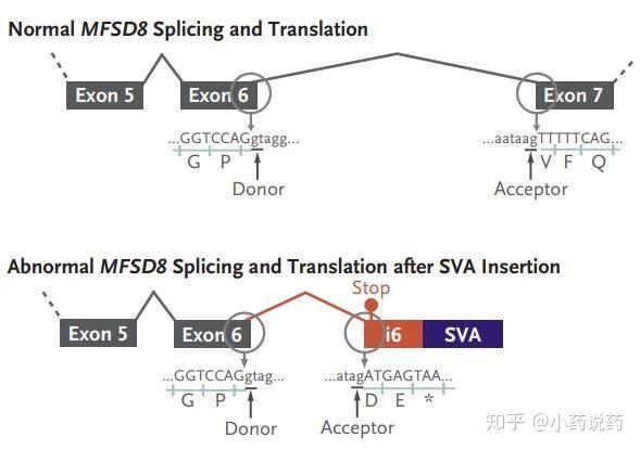 小药说药药物篇-为一个人研发的药物：“Milasen” - 知乎