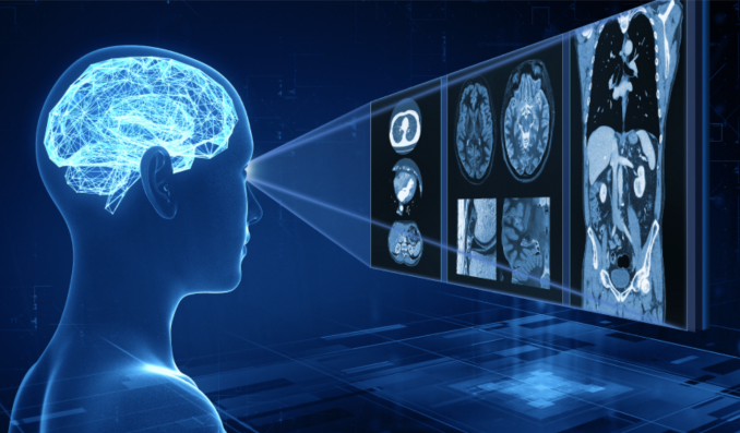 医学图像处理学习讨论（Medical Image Processing and Analysis） - 知乎