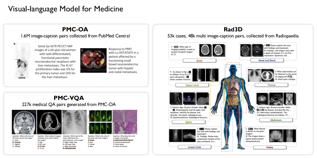 从计算机视觉向医疗AI，上海交大谢伟迪发布多项成果，登Nature子刊/NeurIPS/CVPR等 - 知乎