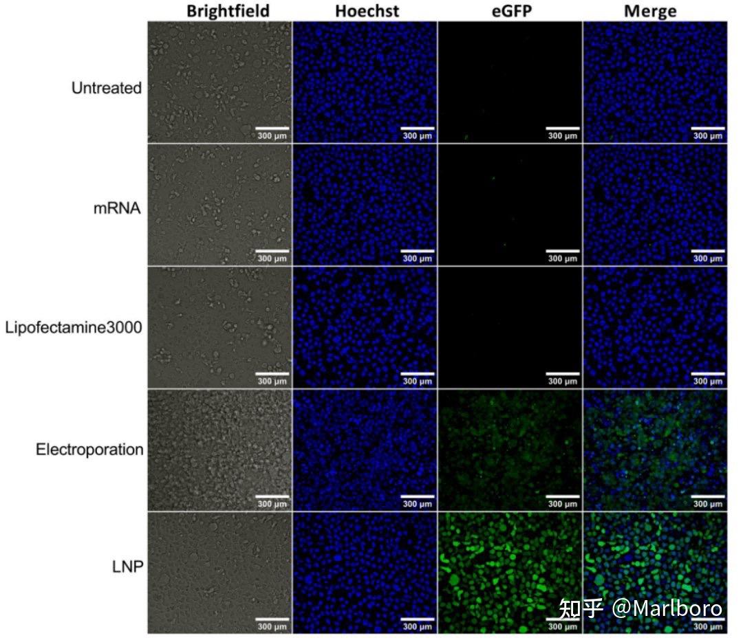 NK细胞的mRNA-LNP制剂筛选和优化 - 知乎