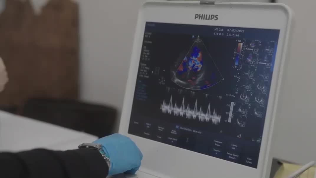 Bryan Johnson｜为什么我要花费数百万美元再次回到 18 岁-Rejuvenation Olympic - 知乎