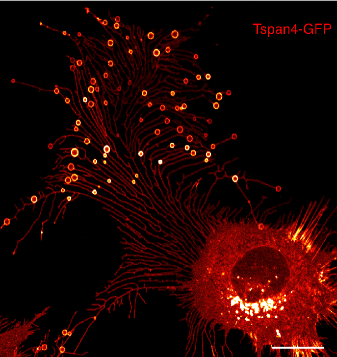 中国科学家发现的新细胞器「迁移体」（migrasome）是什么？起什么样的作用？ - 知乎