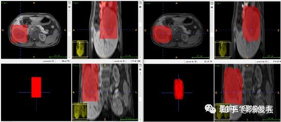 LLD-MMRI2023——多模态MRI 的肝脏病变诊断挑战 - 知乎
