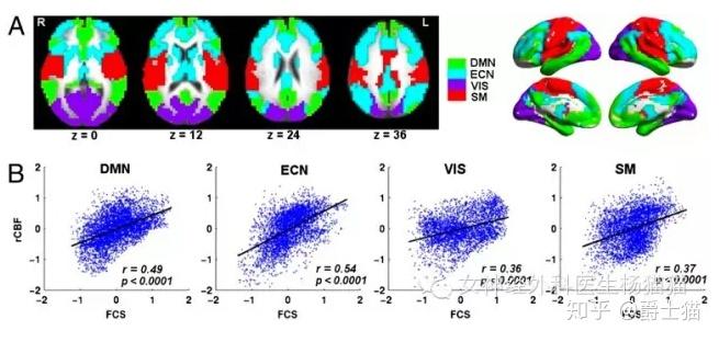 大脑之默认模式 默认网络DMN活动一致性有其结构连接的基础 - 知乎