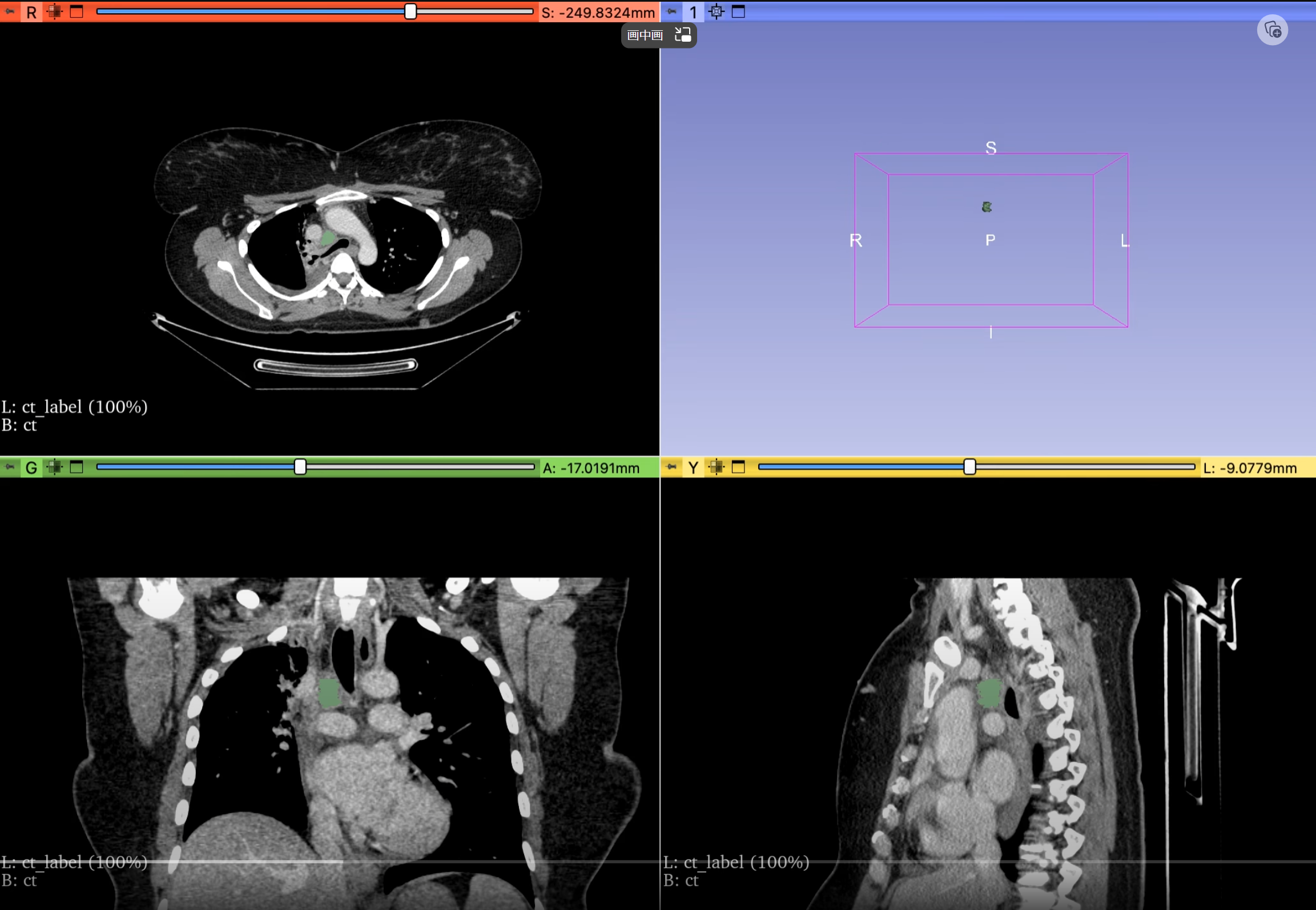 LNQ 2023 数据集介绍 - 知乎