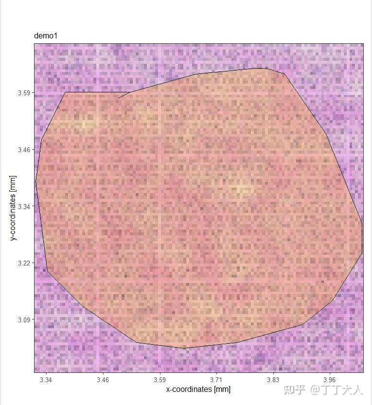 SPATA2-空间转录组梯度分析 - 知乎