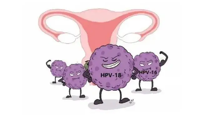 什么是HPV16阳性？ - 知乎