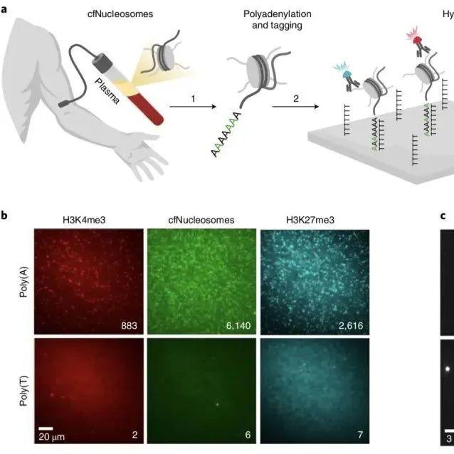 NBT（IF=68）| 迎来新的突破！用1ml血液就能诊断癌症，精确度还高达92% - 知乎