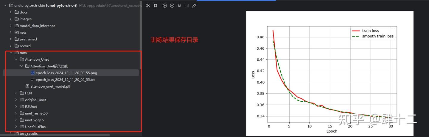 Unet系列模型在自己医学数据集上的使用（unet、unet++、r2net、attention unet以及unet的改进） - 知乎