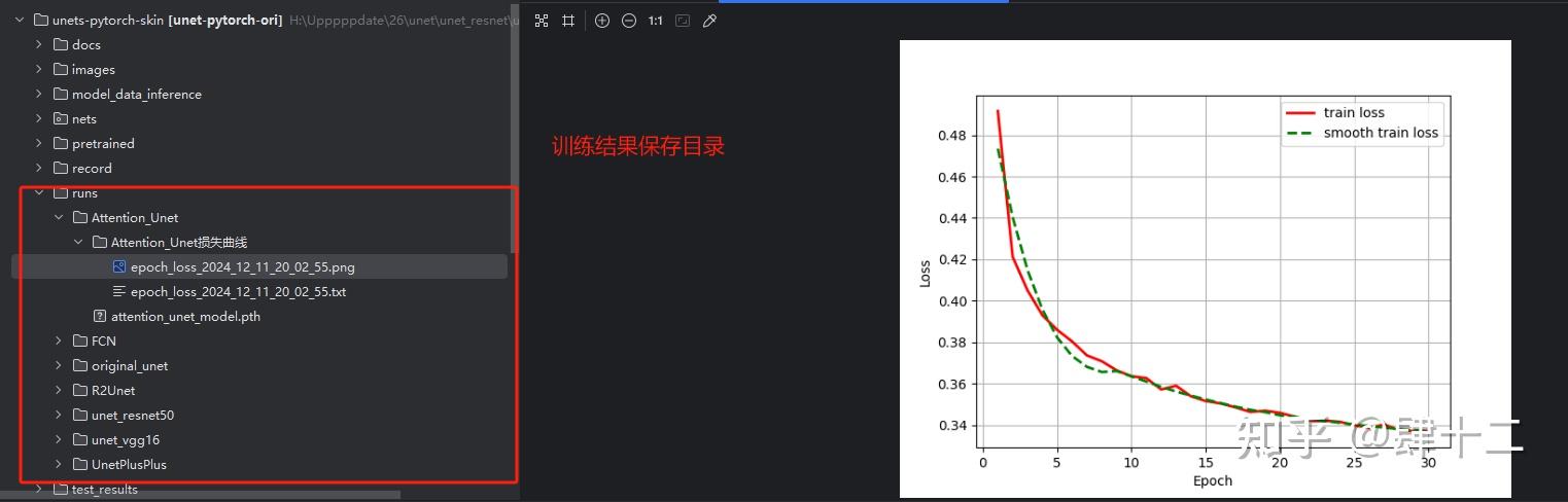 Unet系列模型在自己医学数据集上的使用（unet、unet++、r2net、attention unet以及unet的改进） - 知乎
