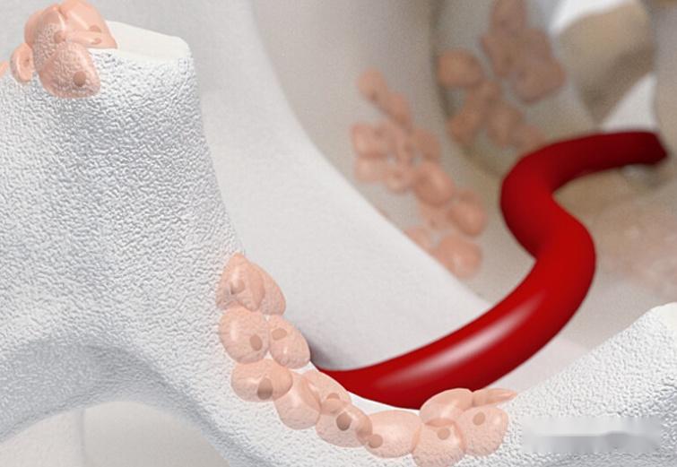 骨再生大咖：瑞士盖氏的故事 - 知乎