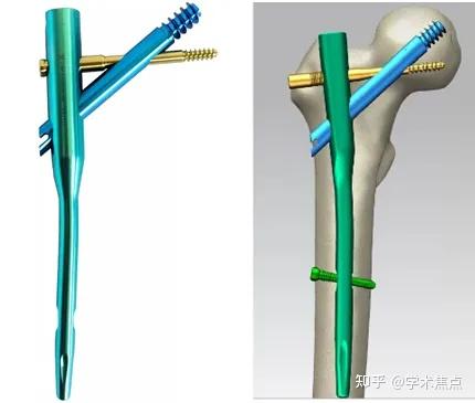 骨折高效愈合！南开院士团队研获新“神器” | 中国工程院院刊Engineering - 知乎