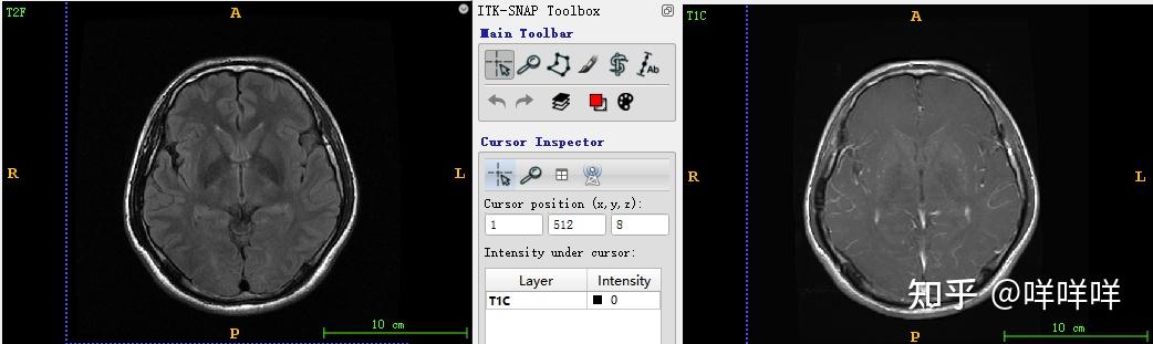 FSL用于脑部MRI图像配准: （flirt与ants刚性与弹性配准） - 知乎