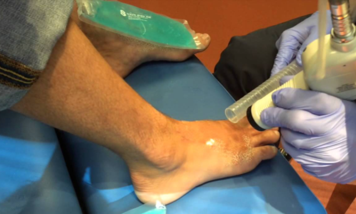 烧伤后免疫反应的复杂性：相关局部和全身并发症综述 2 身材总监医学烧伤压力衣定制&烧伤康复中心 - 知乎