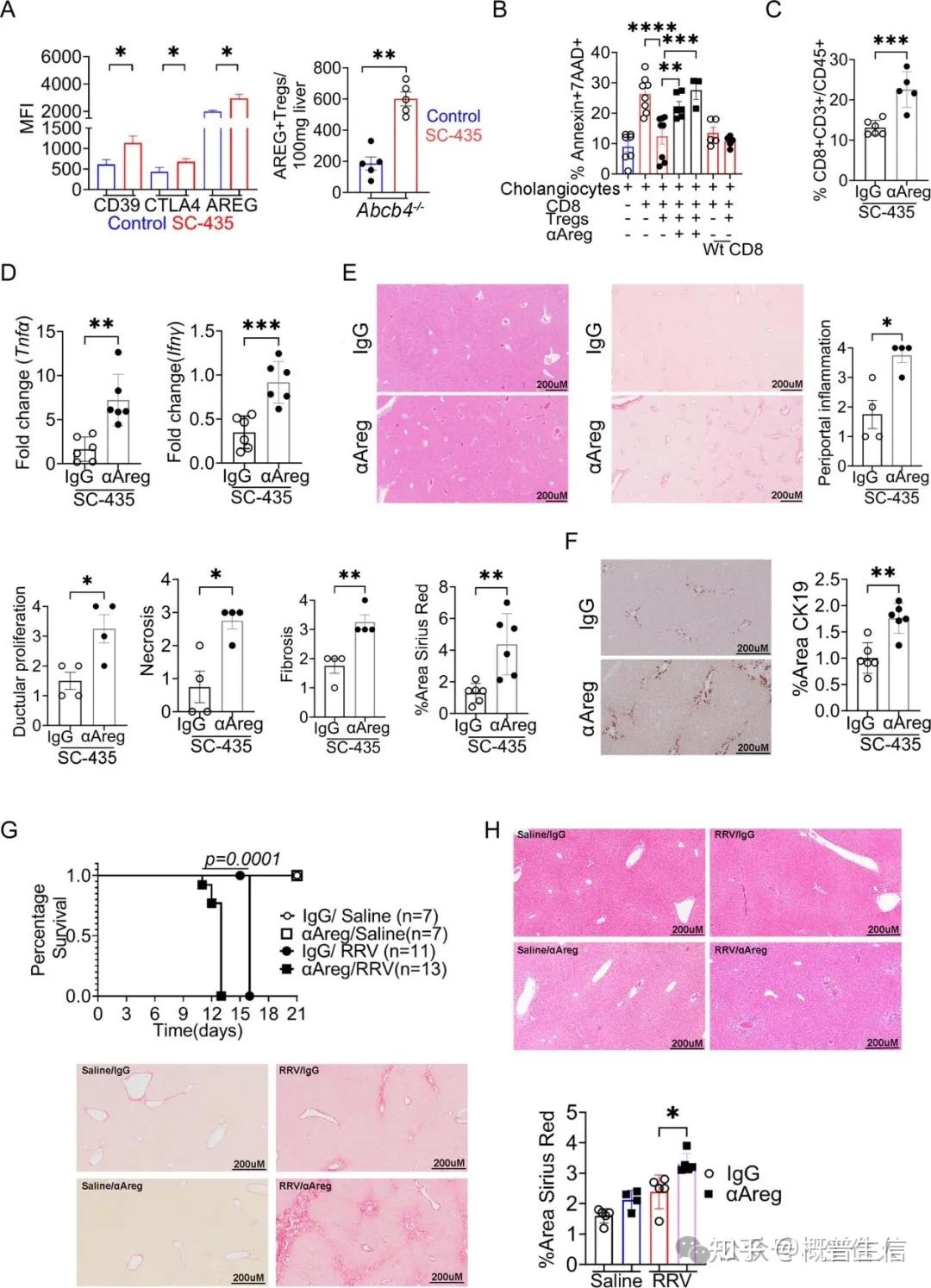 肝病学顶刊【Journal of Hepatology】重磅推出：胆汁酸调控Treg细胞-胆管疾病治疗新靶点 - 知乎