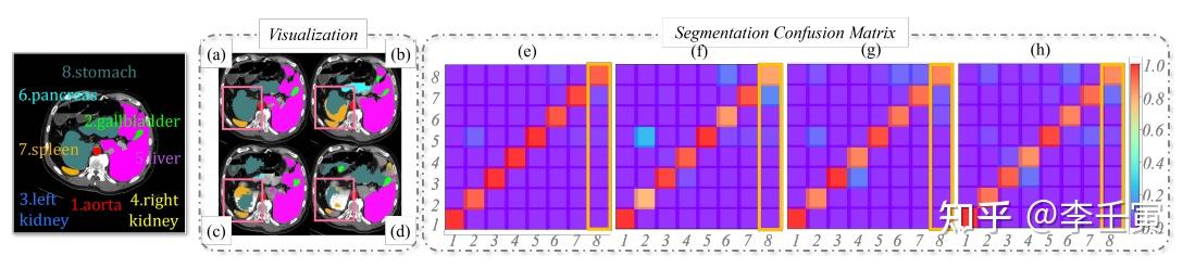 ClassFormer: Exploring Class-Aware Dependency with Transformer for Medical Image Segmentation - 知乎
