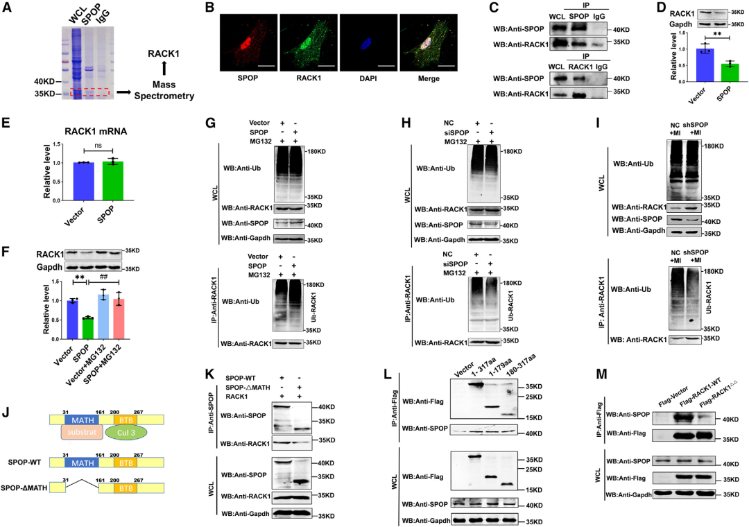 【慢病毒在心脏疾病中的应用】哈尔滨医科大学吕延杰/潘振伟教授联合上海工程技术大学单宏丽教授，团队合作揭示心肌纤维化治疗的潜在靶点 - 知乎