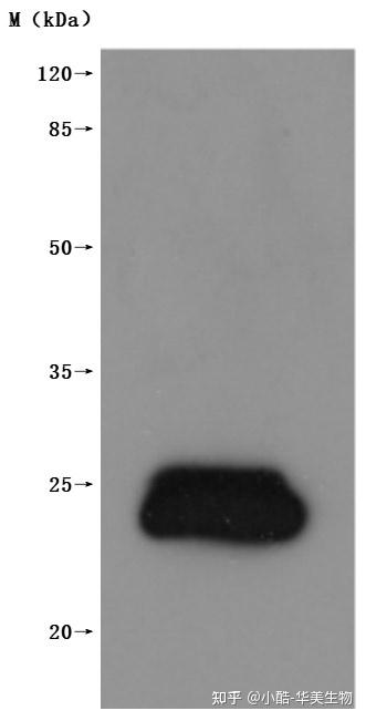 CLDN3：极为关键的紧密连接蛋白，Claudins家族再添药物靶点！ - 知乎