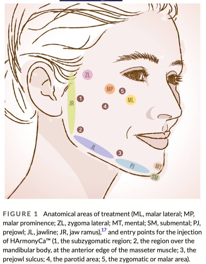 HA/CaHA （HArmonyCa™）混合用于结缔组织修复的回顾研究 - 知乎