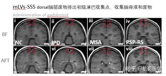 DCE-MRI (Dynamic Contrast-Enhanced Magnetic Resonance Imaging ) 动态对比增强磁 ...