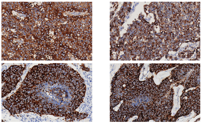 ADC新靶点SEZ6如何从“折戟”到“重生”？ - 知乎