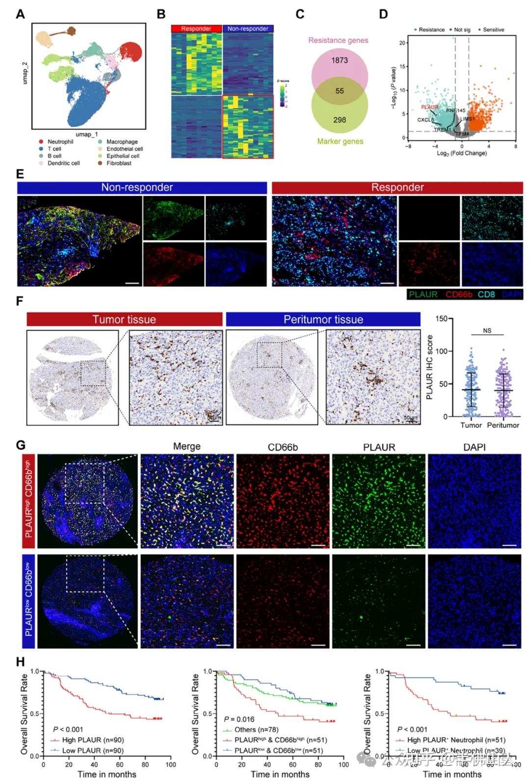 最新14+生信，单细胞识别PLAUR+中性粒细胞塑造免疫抑制微环境，抑制PLAUR 增强抗 PD1 疗效。高分文章经典思路！ - 知乎