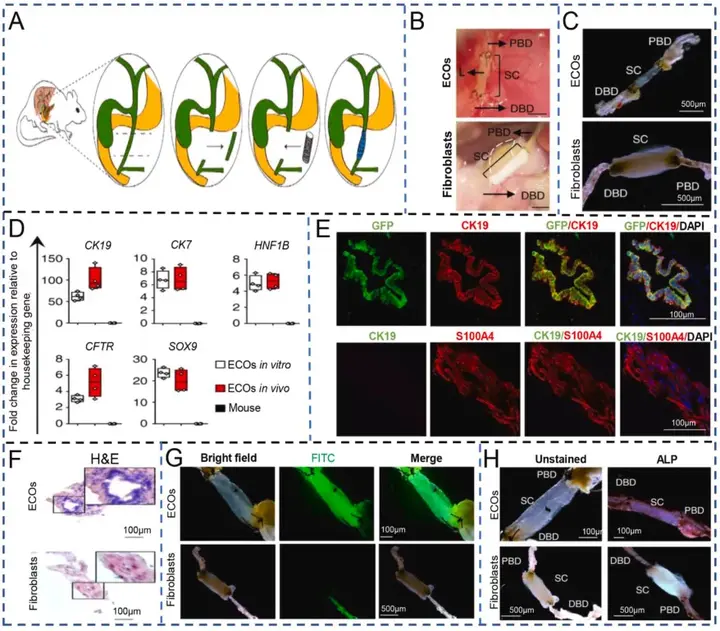《Bioact. Mater.》综述：用作胆道支架的活性材料和表面改性策略 - 知乎