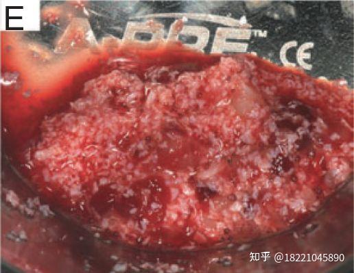 PPP，PRP、PRF都是什么，有什么区别？ - 知乎