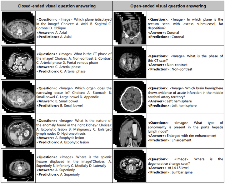 M3D-VQA数据集介绍 - 知乎