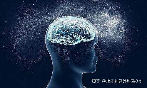 如何正确面对癫痫，走出癫痫阴影？ - 知乎