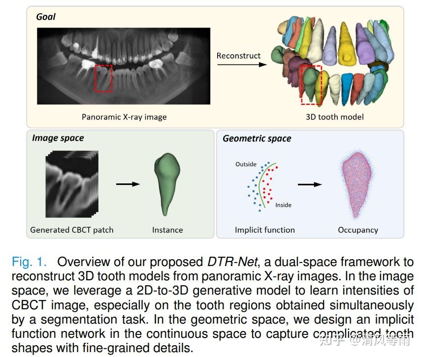 IEEE Transactions on Medical Imaging(TMI)论文推荐：2024年01月(2) - 知乎
