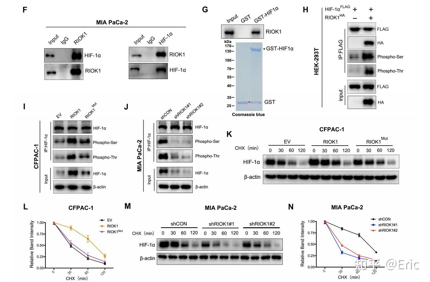 Cancer research | MTAP缺失诱导的代谢重塑增加胰腺癌嘌呤从头合成和糖酵解共靶向敏感性 - 知乎