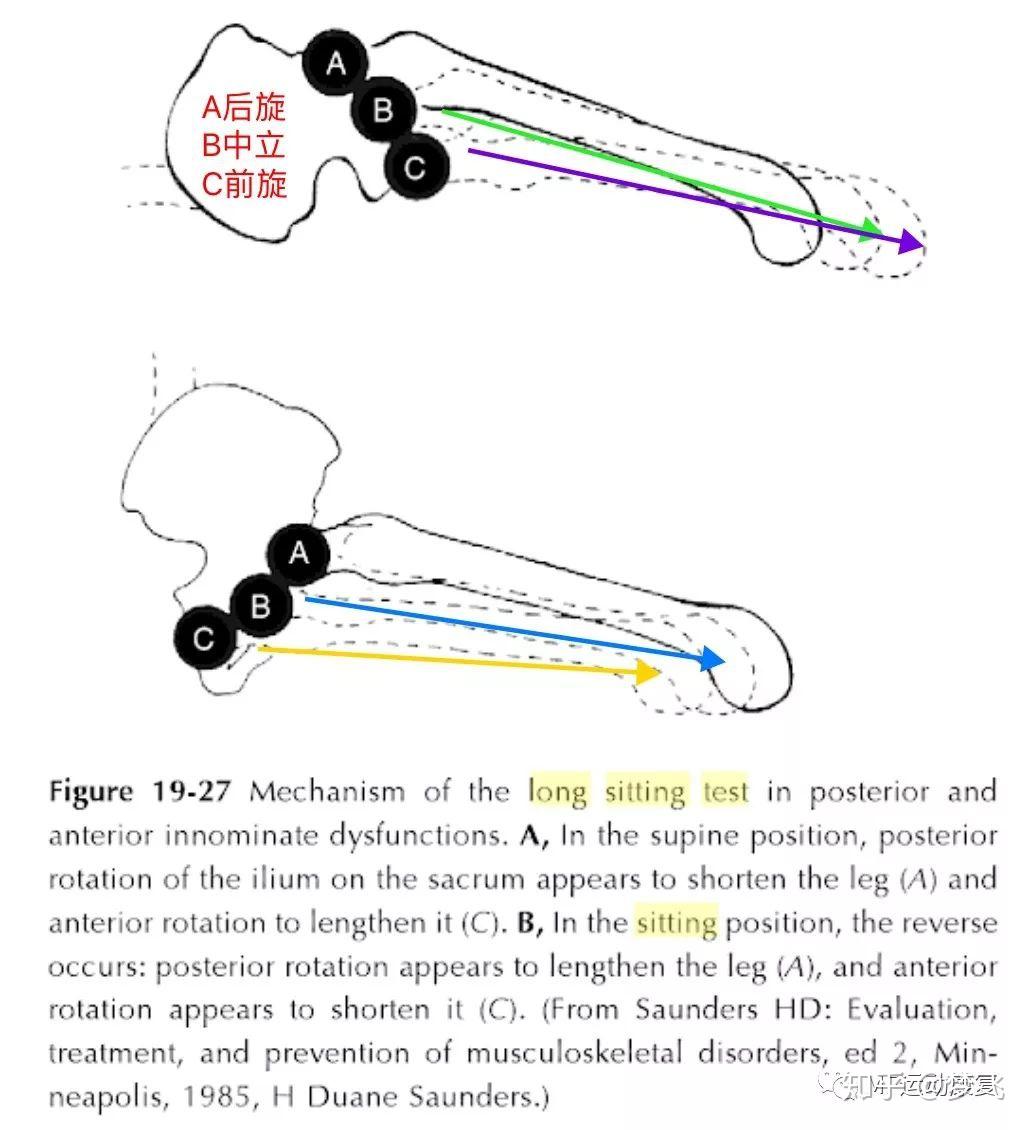 骨科评估 | 长坐测试的解析（Long Sitting Test） - 知乎