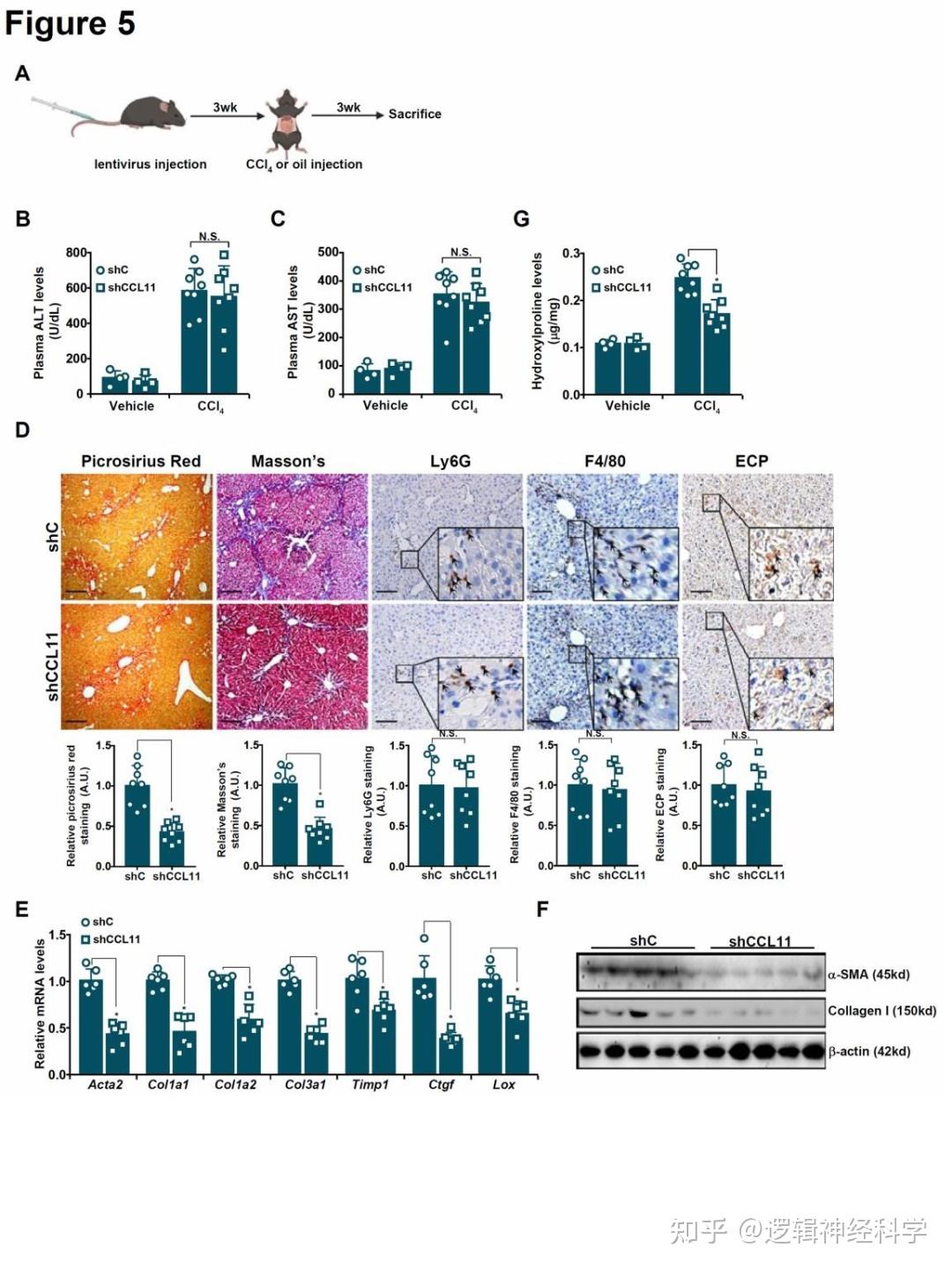 Hepatology︱陆云杰/李子龙/徐涌团队合作发现CCL11在肝纤维化中的作用和意义 - 知乎