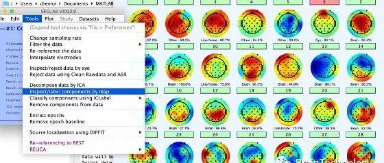 EEGLAB系列教程5：数据预处理2（ICA去伪迹） - 知乎