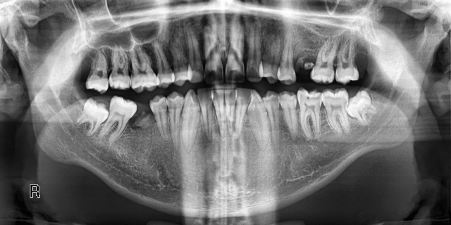MMSegmentation的用法（手把手入门教程）搭配Colab，训练自己的数据 - 知乎