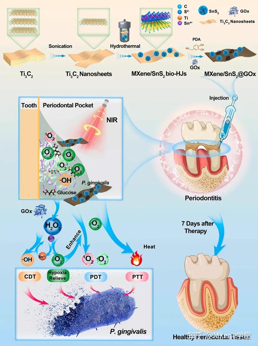 《CEJ》 | MXene-SnS2异质结构材料用于增强抗菌抗炎治疗 - 知乎