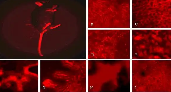 近红外二区有机小分子荧光探针；IR-FEP和IR-FTAP探针；NIR-II荧光探针TB1 - 知乎
