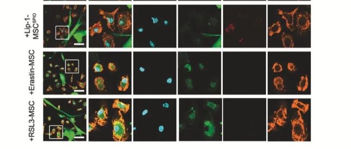 CDD丨铁死亡 MSCs 通过促进巨噬细胞胞吐作用保护小鼠免受脓毒症 - 知乎
