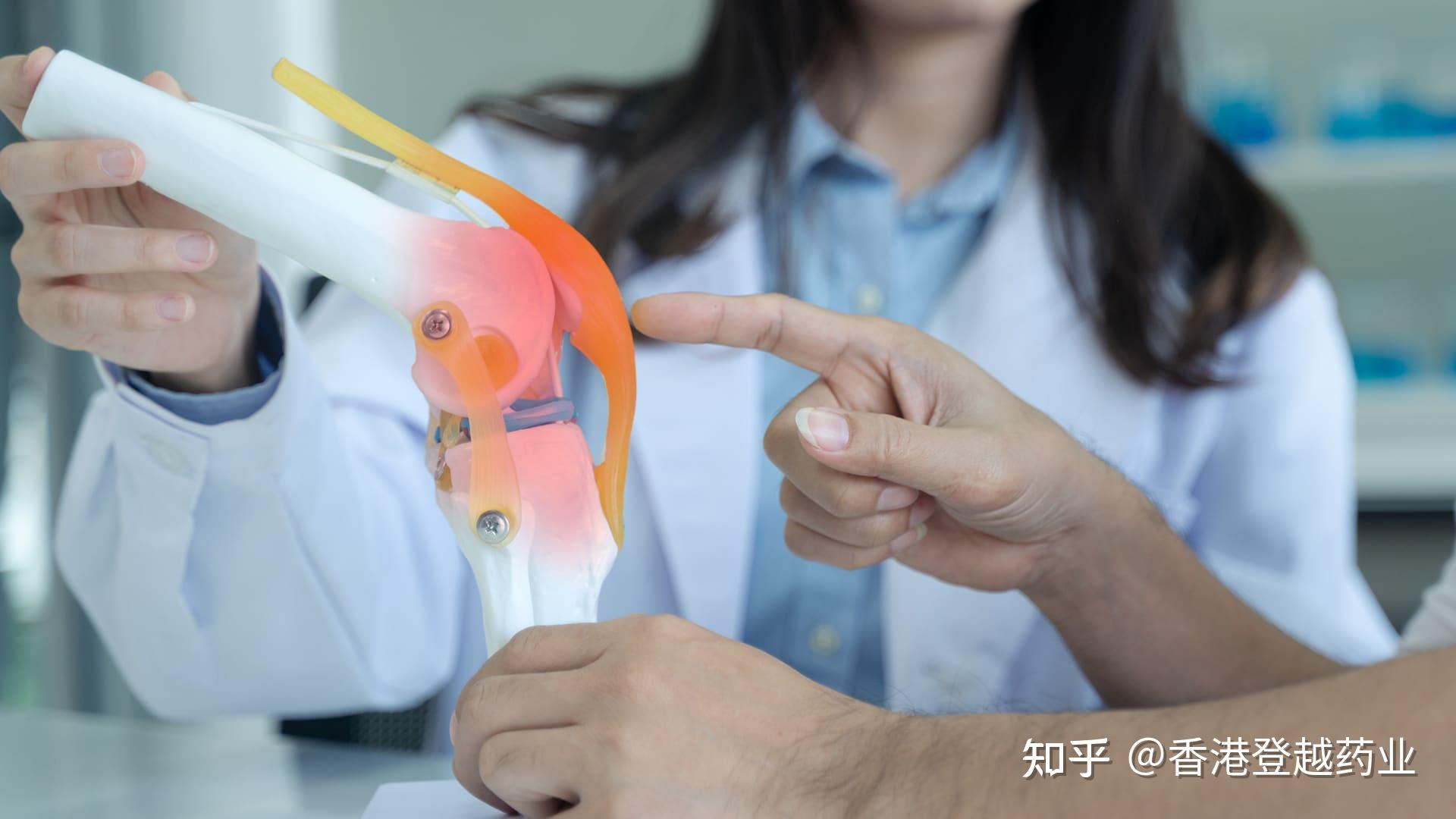 Emactuzumab 用于治疗腱鞘巨细胞瘤（TGCT）获得FDA快速通道认定 - 知乎