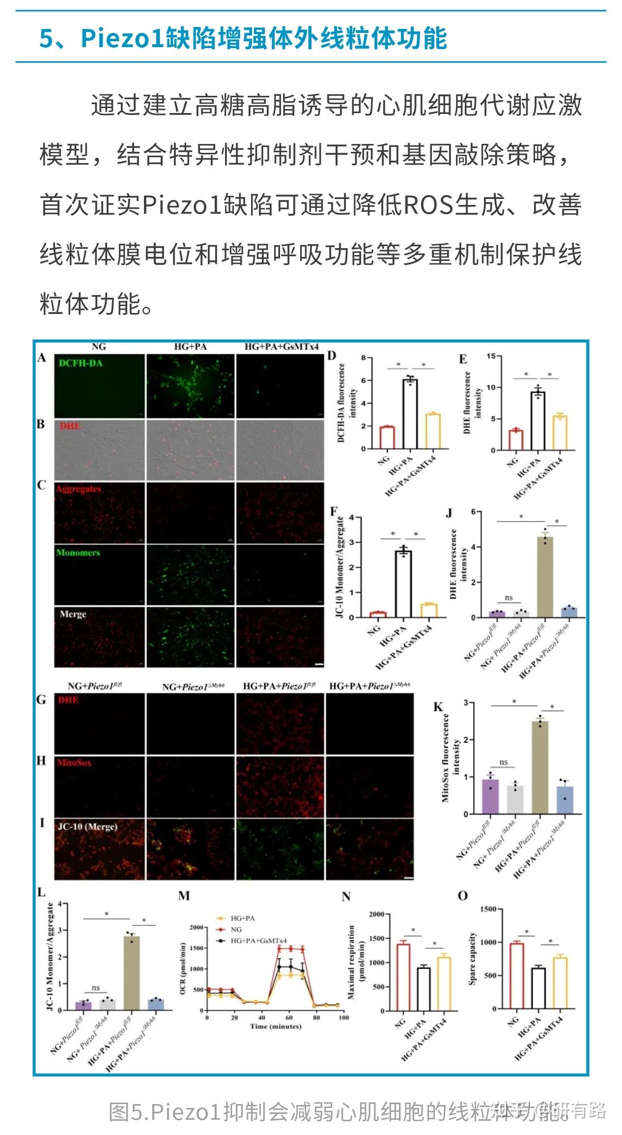 Piezo1喜登双科顶刊！"表型+分子+机制+干预"，山东中医药大学首揭Piezo1通过线粒体动态调控改善糖尿病心肌病~ - 知乎