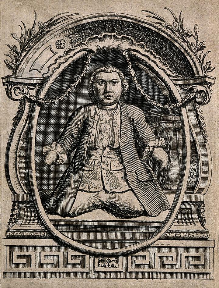 他天生没有手脚，但他是名留青史的魔术师：Matthew Buchinger - 知乎