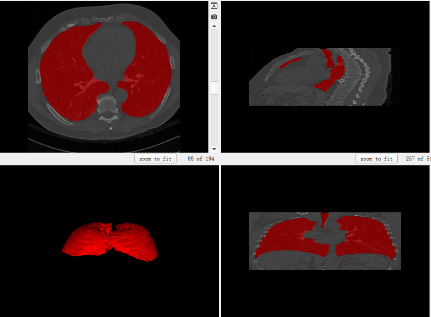 LUNA16 肺结节检测数据集介绍 - 知乎