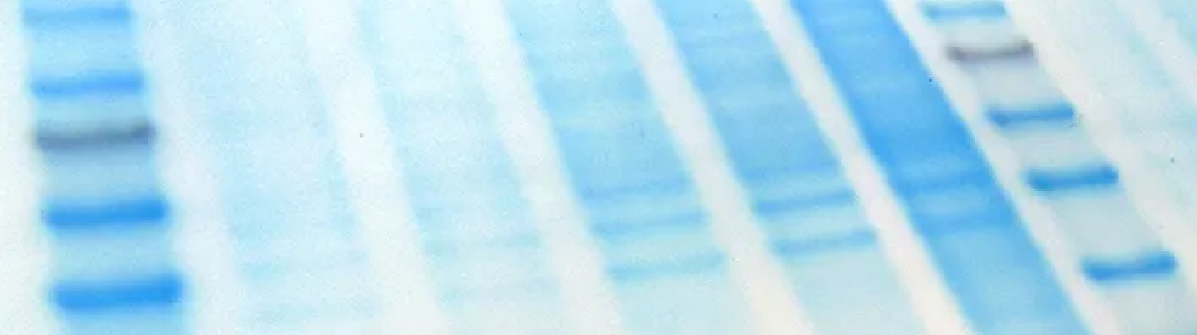 ImageJ实用技巧——Western Blot定量分析深入探究(定量分析篇) - 知乎