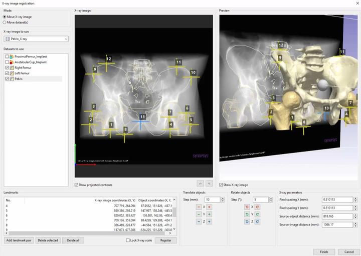 【Simpleware 手册】X 射线 - 知乎