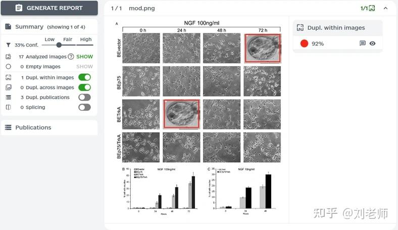 ImageTwin官方论文图片查重深度指南 官网权威解答 - 知乎