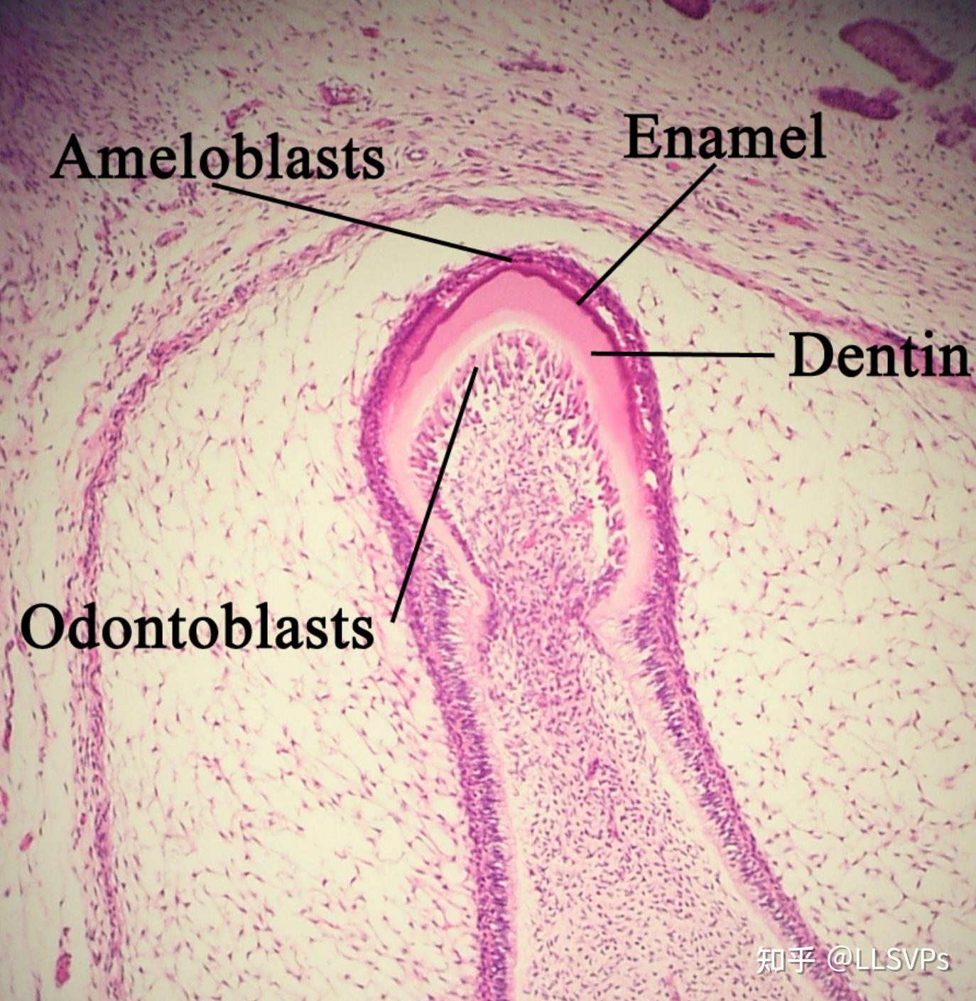牙釉质（tooth enamel） - 知乎
